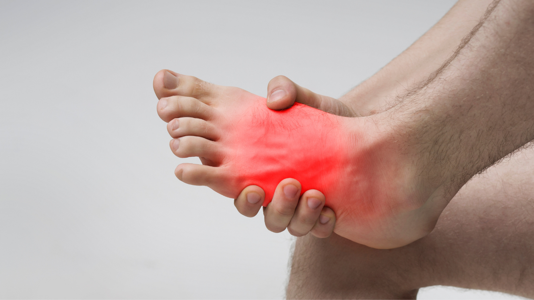 How to Relieve Foot Arch Pain – My Foot Guy